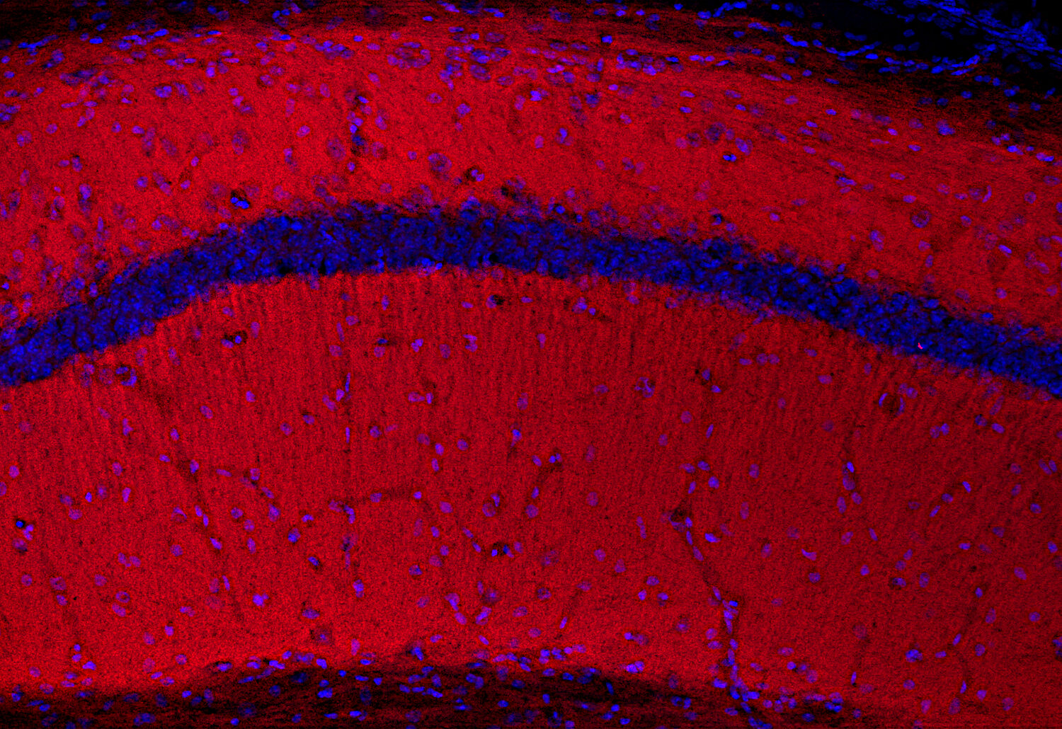 Synaptic Systems - PSD95